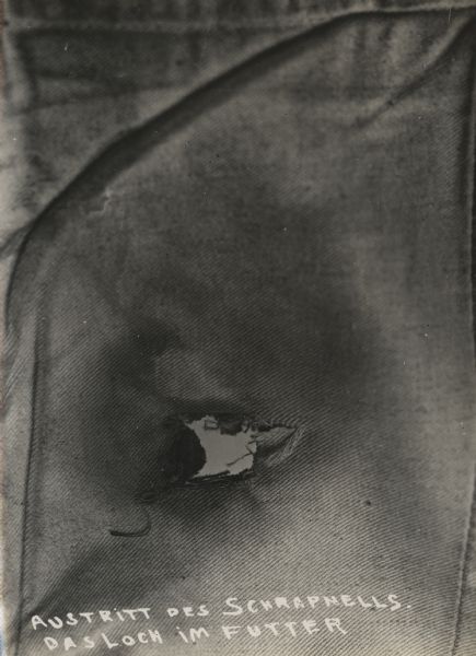 Remarkable Path of a Piece of Shrapnel | Photograph | Wisconsin ...